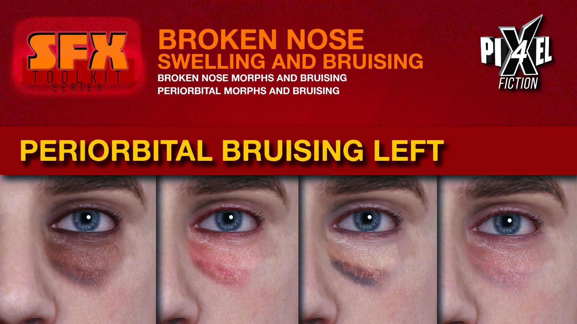 Full Broken Nose