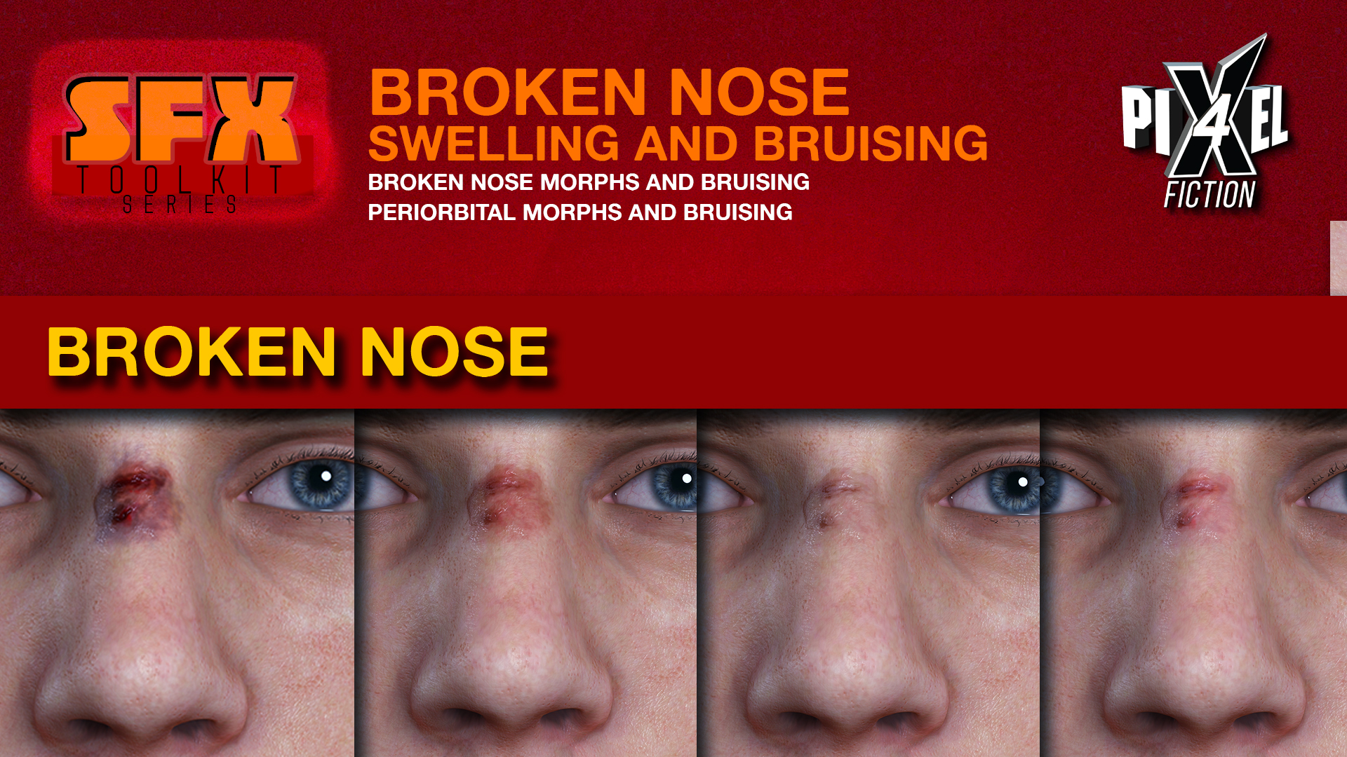 Full Broken Nose